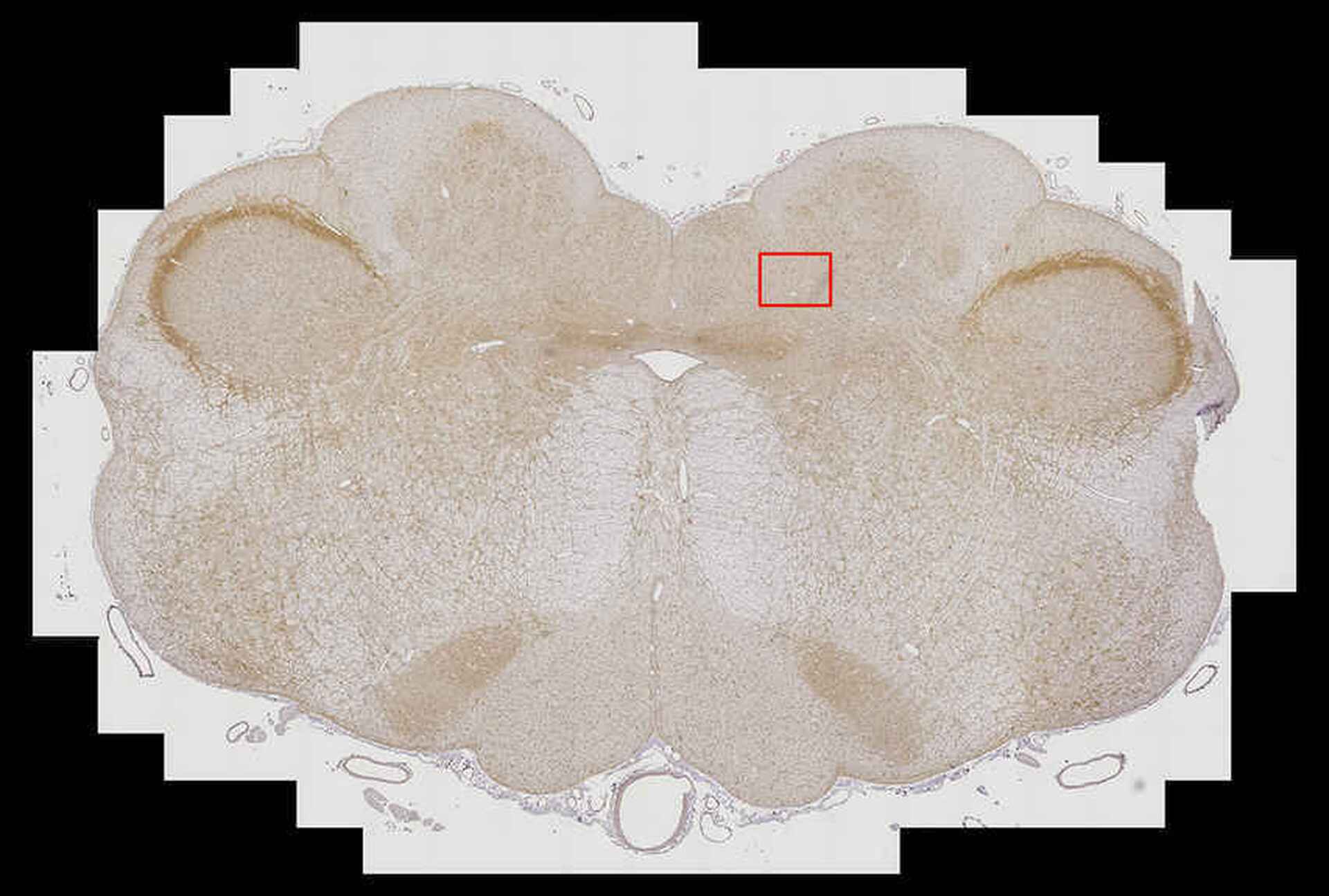 Slide Scanning | Recherche clinique | Solutions | Nikon Instruments Inc.