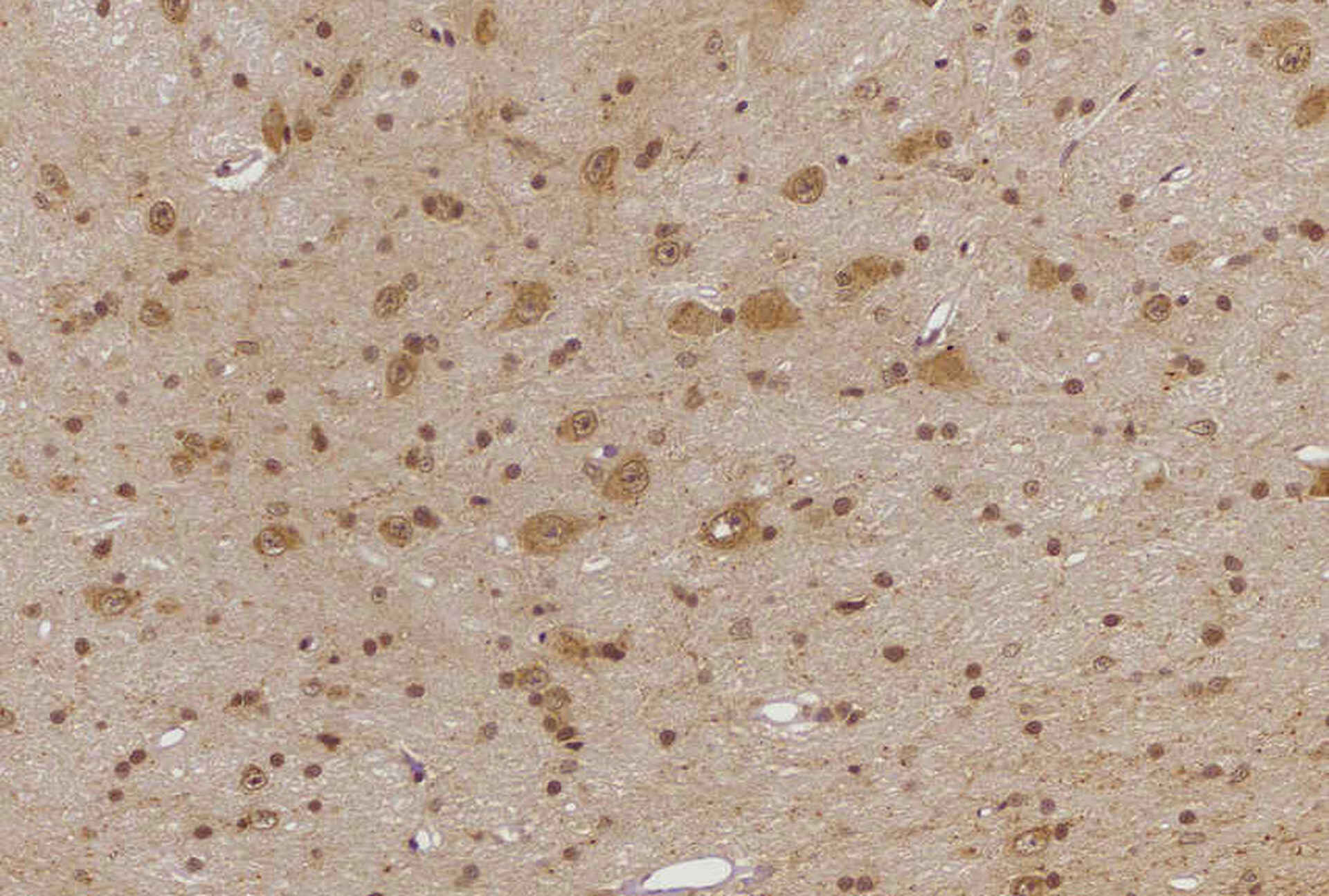 Slide Scanning | Clinical Research | Solutions | Nikon Instruments Inc.