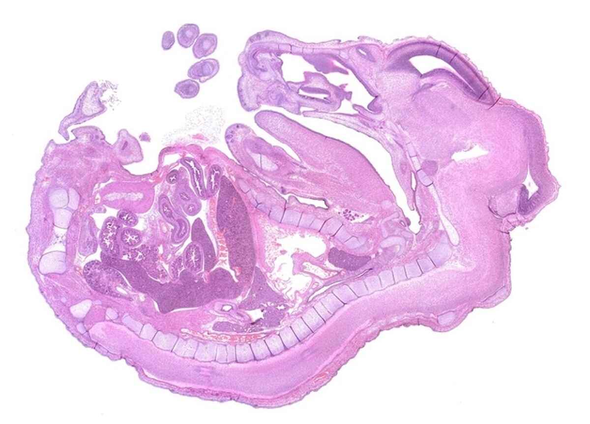 Slide Scanning | Clinical Research | Solutions | Nikon Instruments Inc.