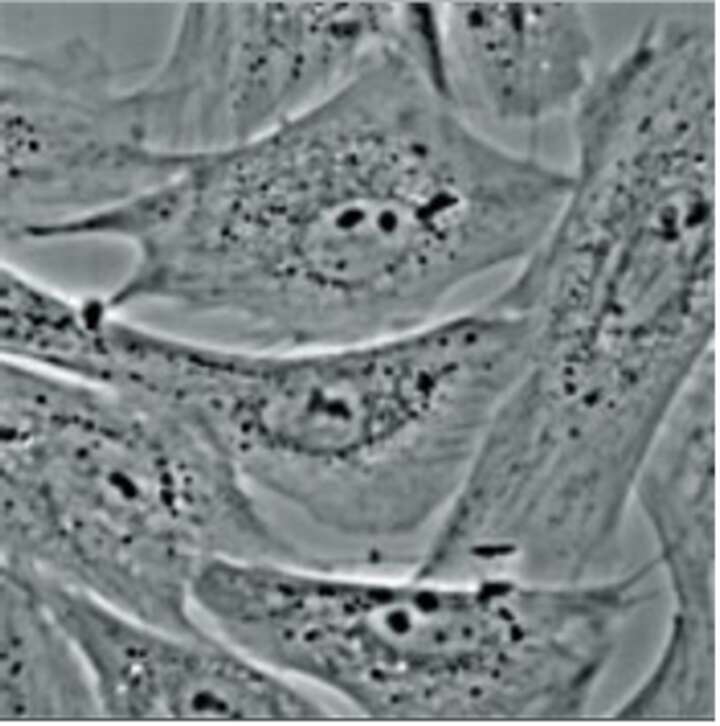 Tissue Culture | Life Sciences | Solutions | Nikon Instruments Inc.